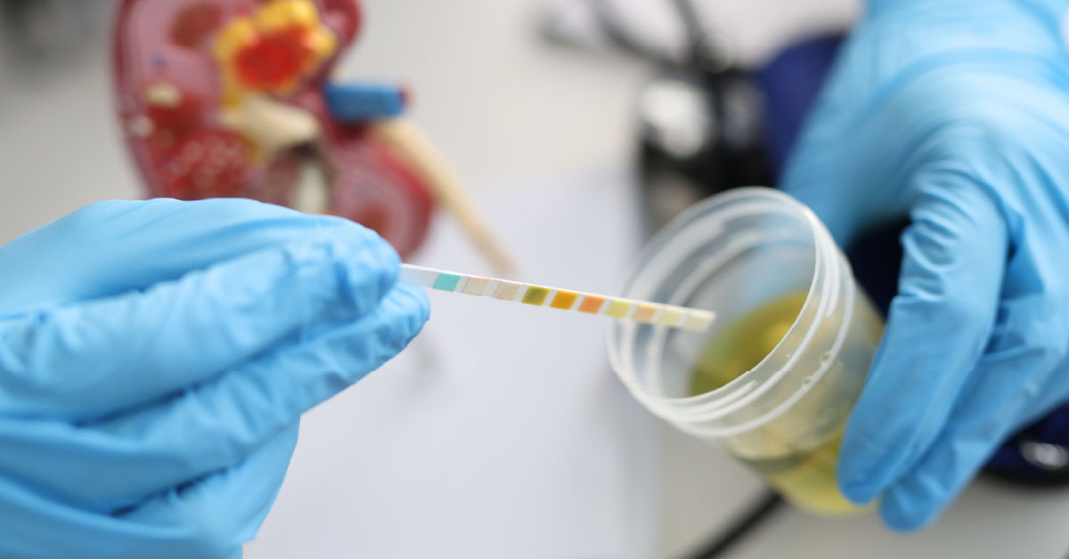 Análisis de sedimento de orina - Bioreferencia