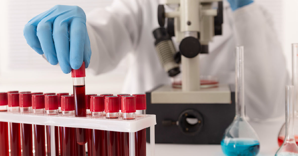 Significado y análisis del CHCM en el Hemograma - BioReferencia